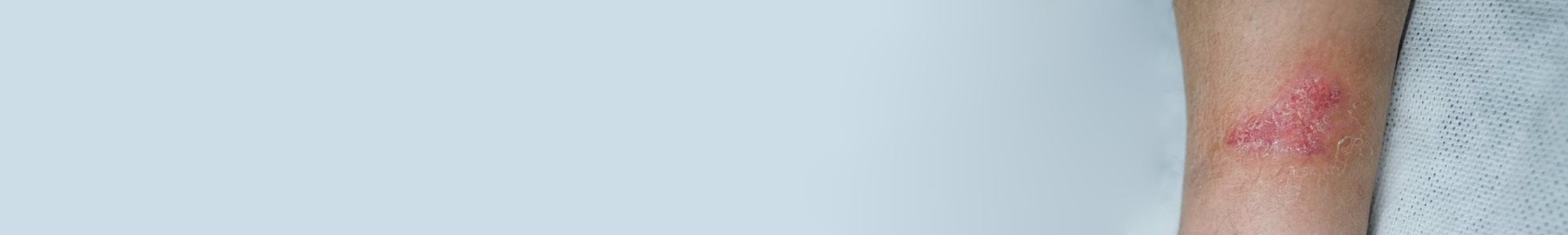 Compresión Alta 1 Capa (30/40 mmHG) – Varimed